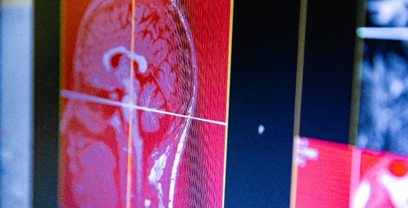 Andrew Conner, MD | Neurosurgeon in Oklahoma City, OK